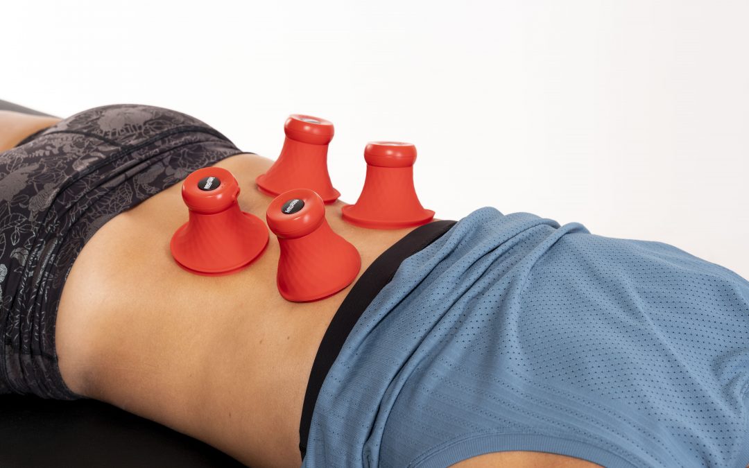 Uncover the NEW Science Behind Myofascial Cupping: A Neurosensory Solu ...